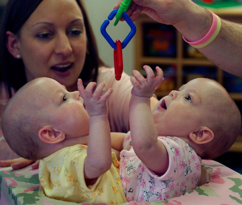 A sziámi ikrek 2006-ban estek át szétválasztó műtéten – próbálj meg nem ...