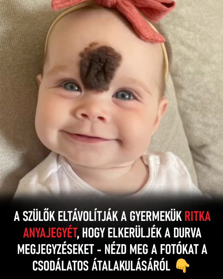 A szülők elrejtették a baba arcát, hogy megvédjék őt a bámulástól ...